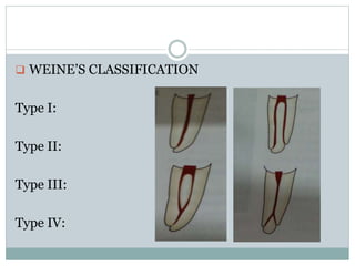 Anatomy of pulp chamber | PPTX