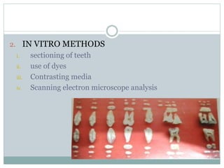 Anatomy of pulp chamber | PPTX