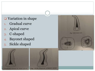 Anatomy of pulp chamber | PPTX