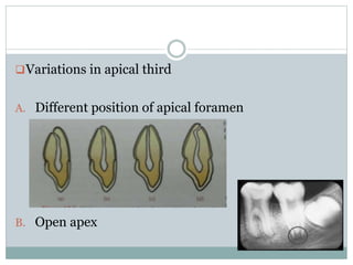 Anatomy of pulp chamber | PPTX