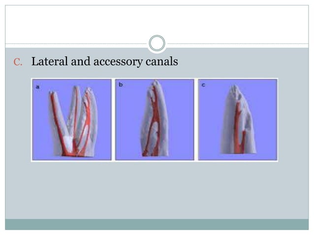 Anatomy of pulp chamber | PPTX | Dental Health | Diseases and Conditions