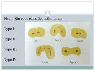 Anatomy of pulp chamber | PPTX