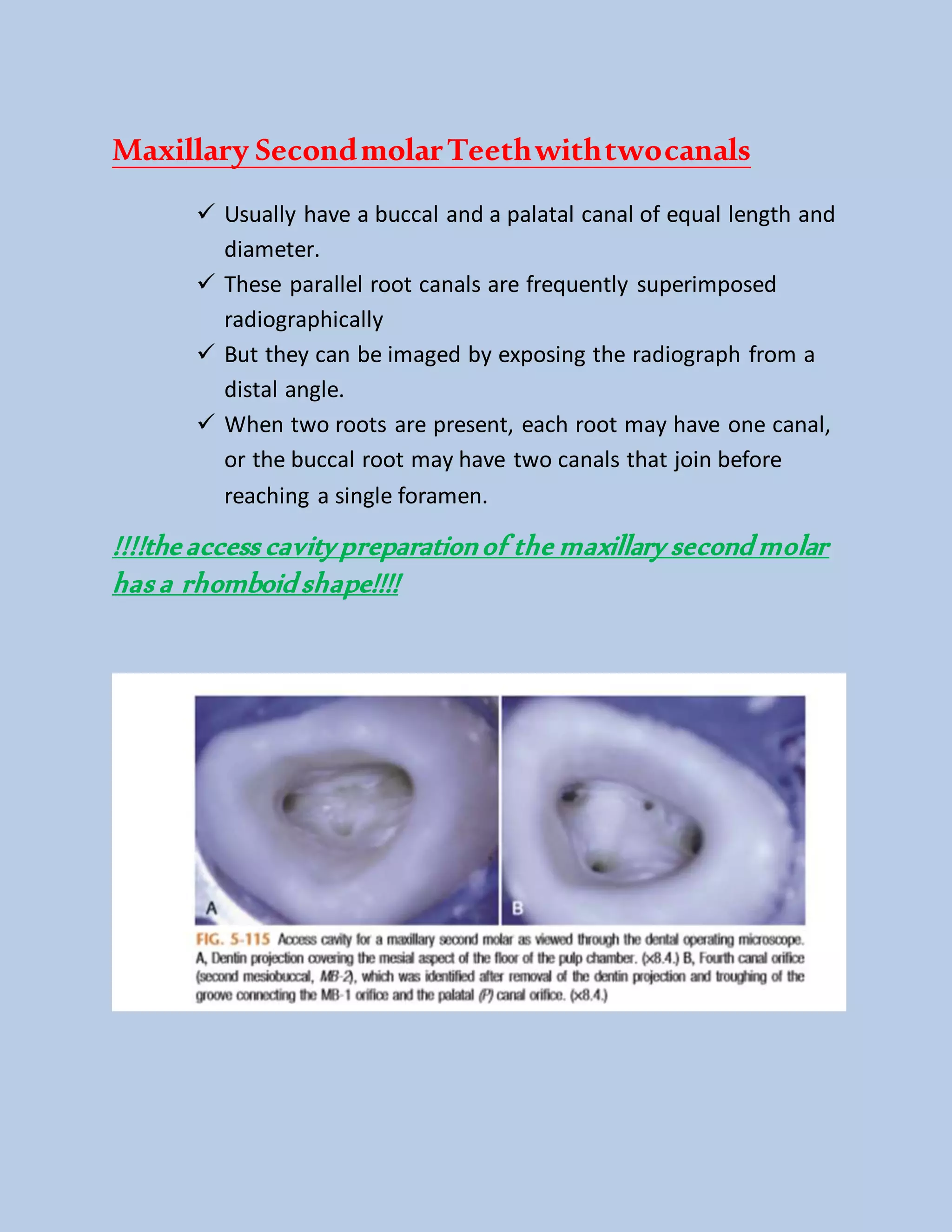 Access opening of second and third molars | DOCX