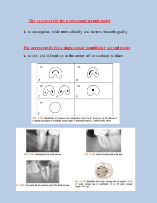 Access opening of second and third molars | DOCX