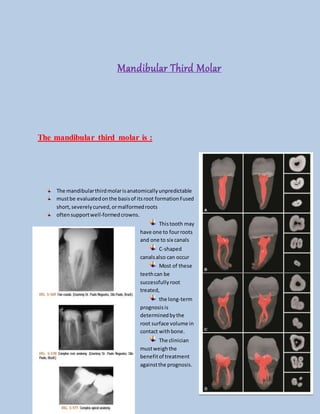 Access opening of second and third molars | DOCX