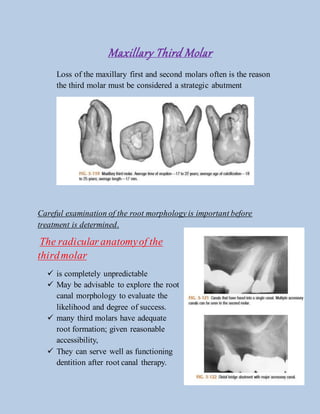Access opening of second and third molars | DOCX