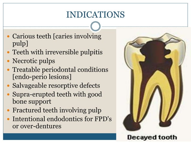 Endodontics - An Introduction | PPTX | Dental Health | Diseases and ...