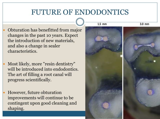 Endodontics - An Introduction | PPT