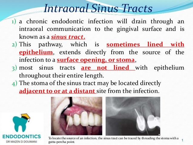 Endodontics dr mazen doumani