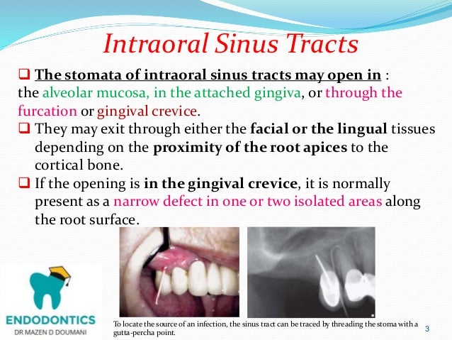 Endodontics dr mazen doumani