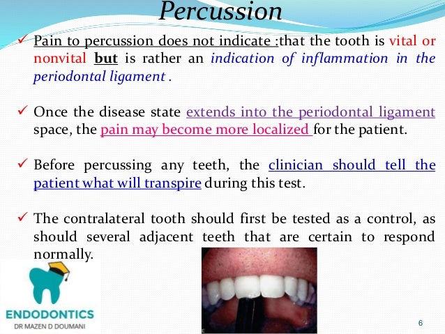Endodontics dr mazen doumani