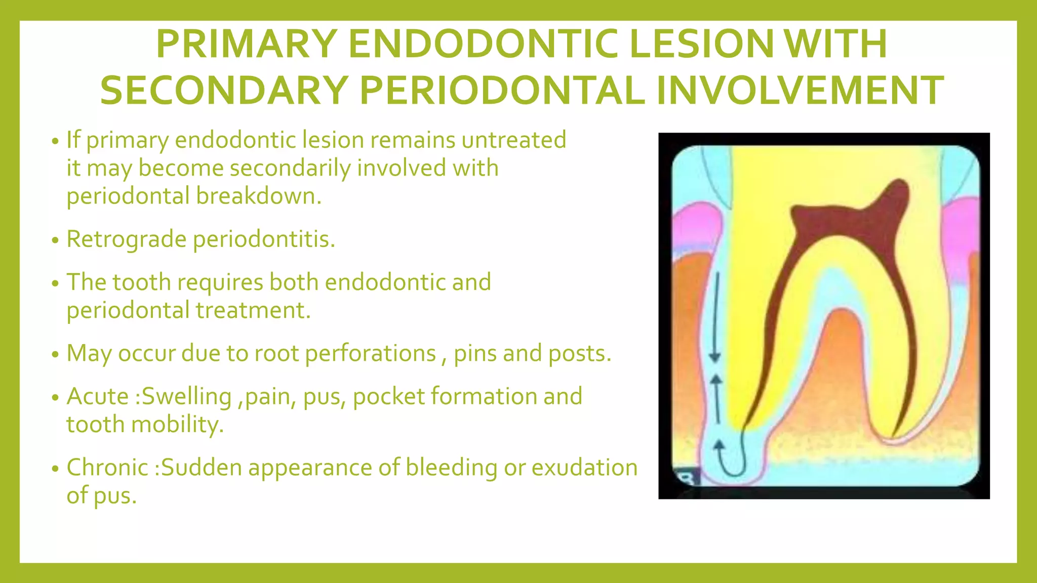 Endodontics periodontal lesions | PPTX