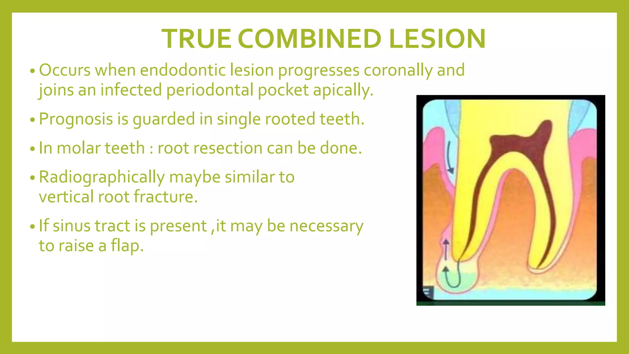 Endodontics periodontal lesions | PPTX