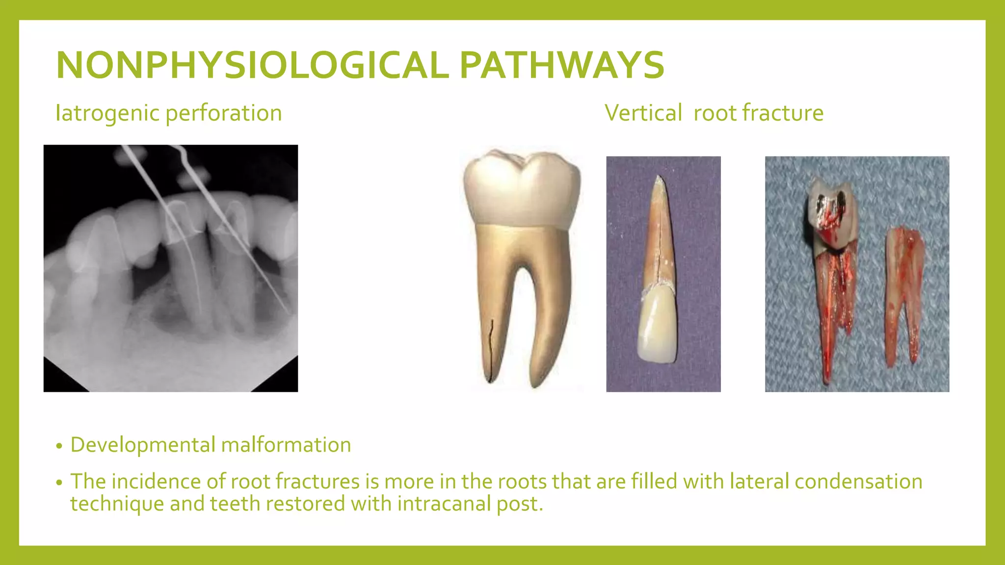 Endodontics periodontal lesions | PPTX