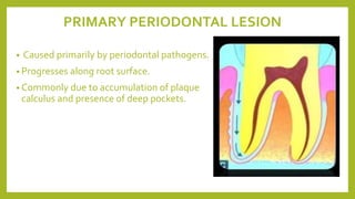 Endodontics periodontal lesions | PPTX
