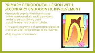 Endodontics periodontal lesions | PPTX | Dental Health | Diseases and ...