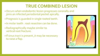Endodontics periodontal lesions | PPTX | Dental Health | Diseases and ...