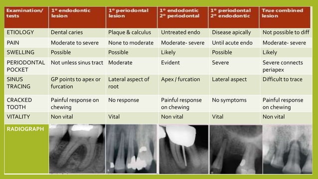 Endodontics periodontal lesions | PPTX | Dental Health | Diseases and ...