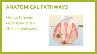 Endodontics periodontal lesions | PPTX | Dental Health | Diseases and ...