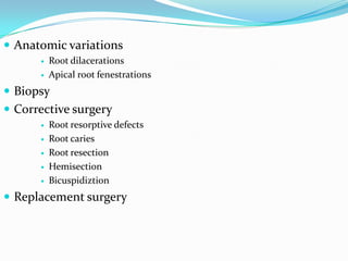Endodontic surgery | PPTX