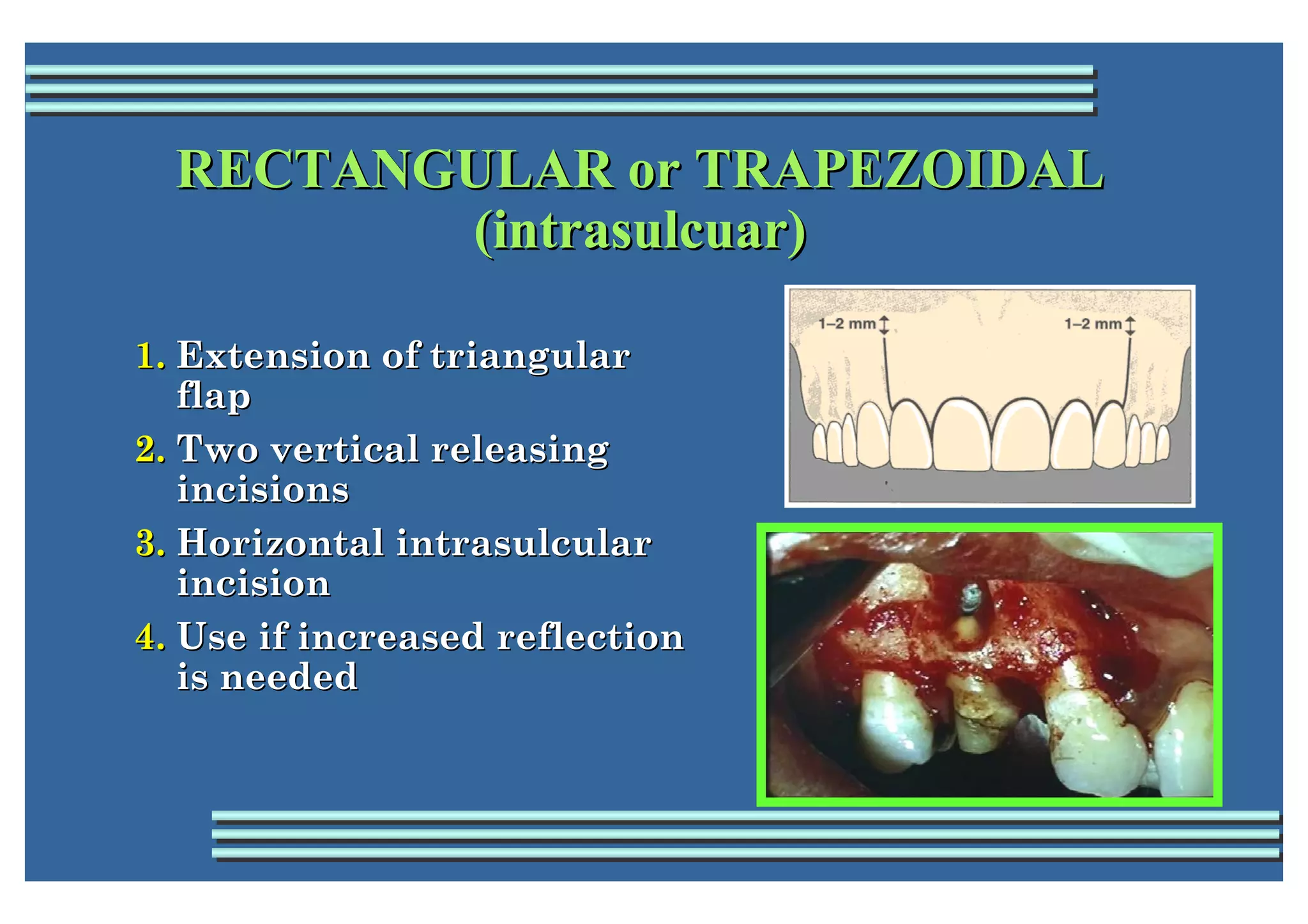 Endodontic surgery | PDF