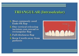 Endodontic surgery | PDF