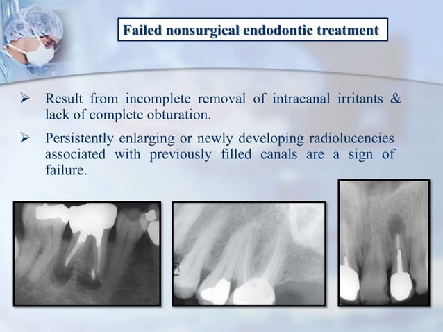 Endodontic surgery | PPTX | Dental Health | Diseases and Conditions