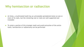 Endodontic surgery | PPTX