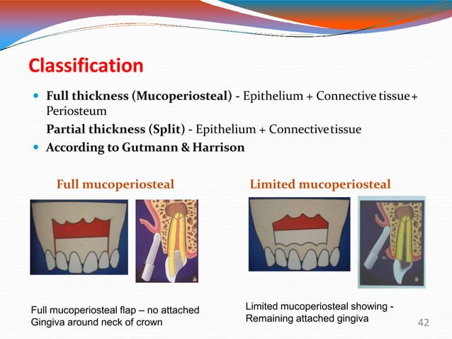 Endodontic surgery | PPTX | Dental Health | Diseases and Conditions