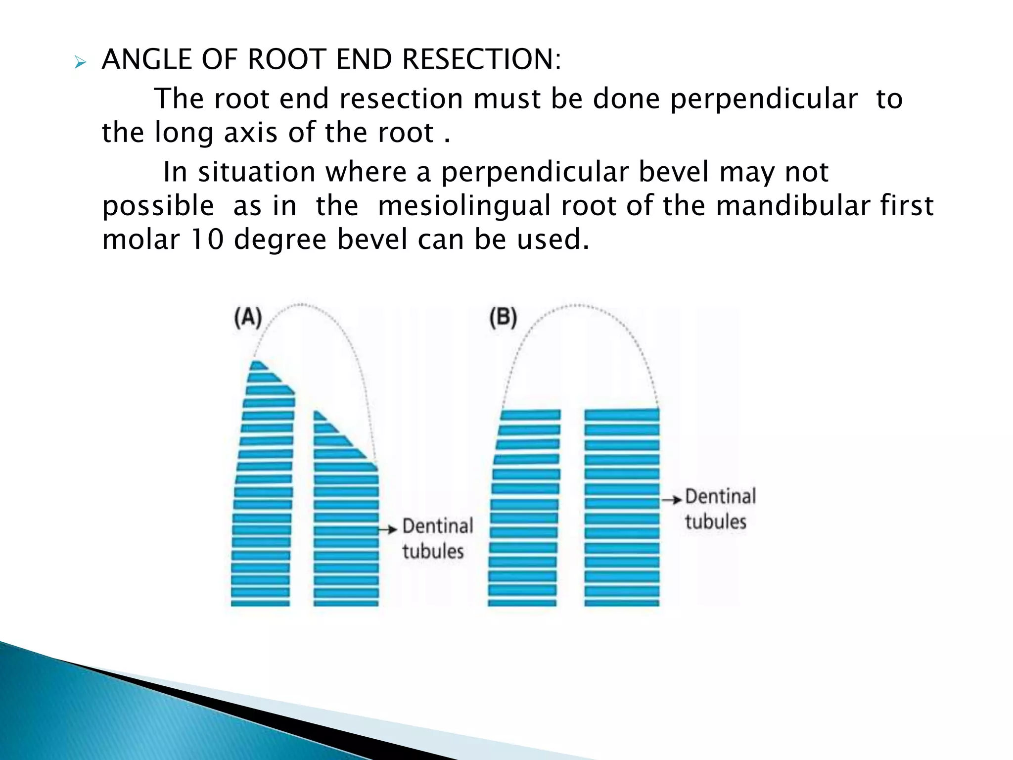 Endodontic surgery.pptx
