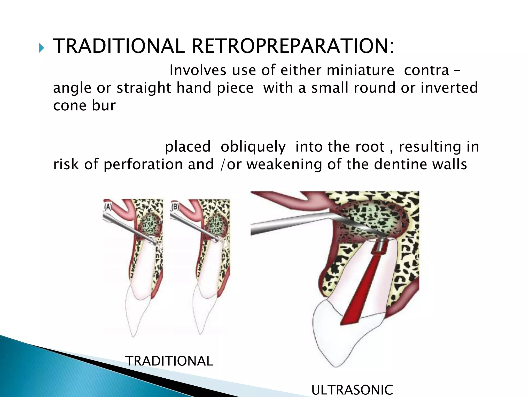 Endodontic surgery.pptx