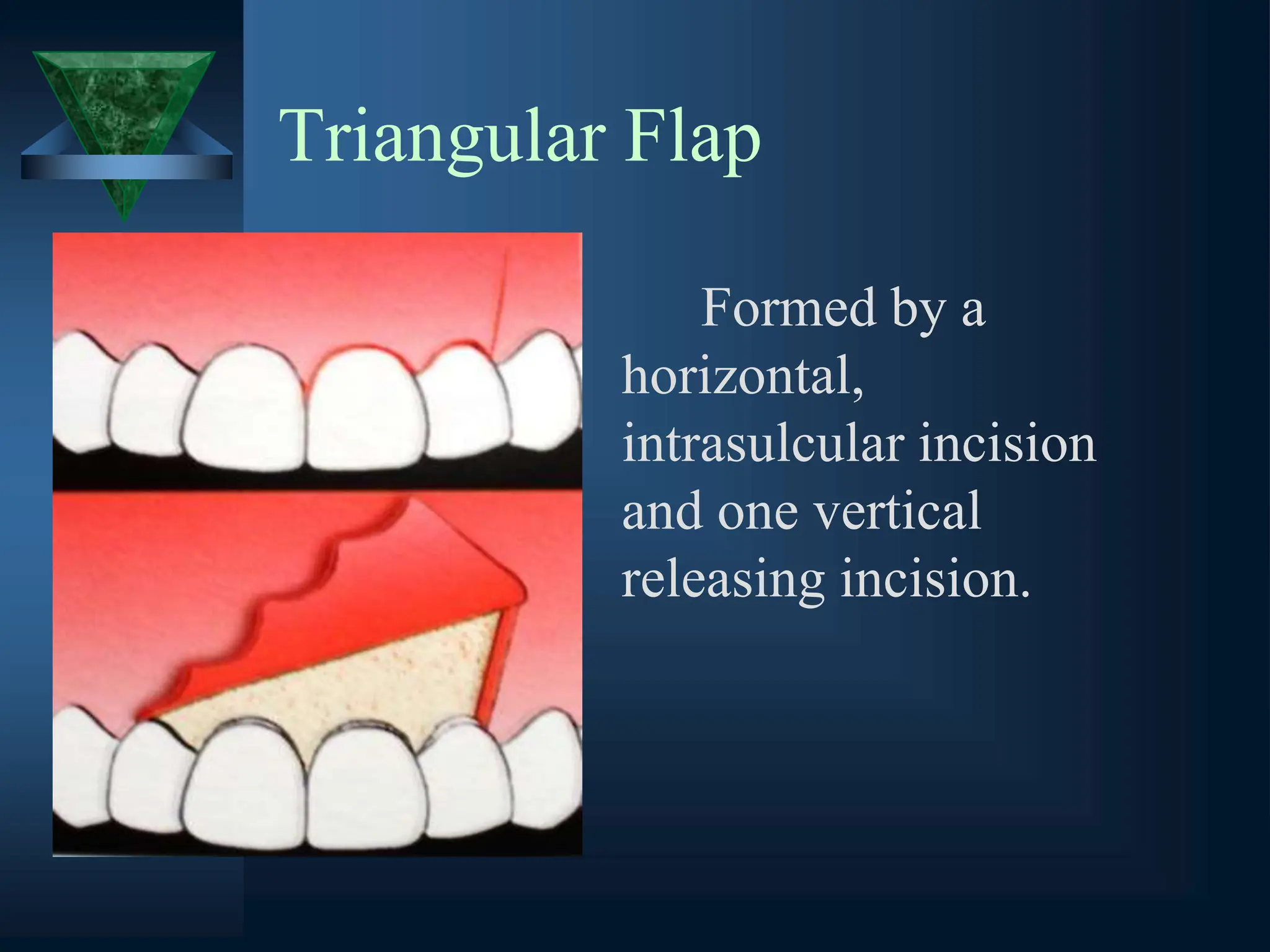 ENDODONTIC SURGERY.pptx