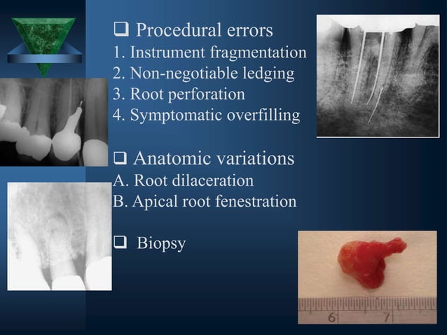 ENDODONTIC SURGERY.pptx