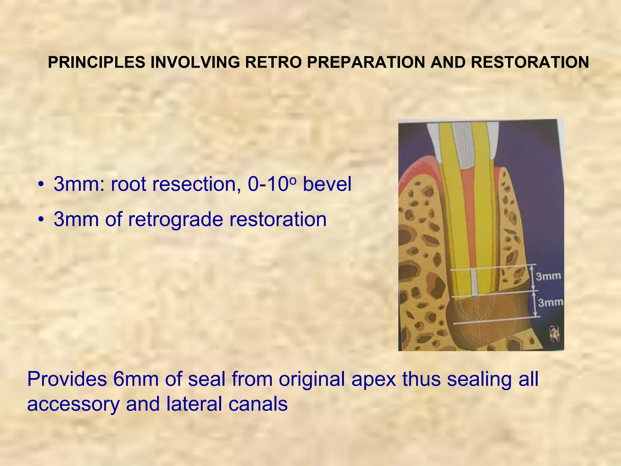 Basic principles of Endodontic Surgery . | PPTX
