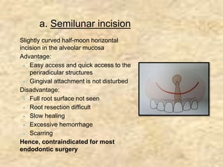Basic principles of Endodontic Surgery . | PPTX