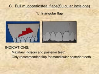 Basic principles of Endodontic Surgery . | PPTX