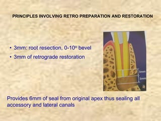 Basic principles of Endodontic Surgery . | PPTX