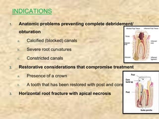 Basic principles of Endodontic Surgery . | PPTX