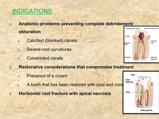 Basic principles of Endodontic Surgery . | PPTX