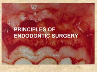 Basic principles of Endodontic Surgery . | PPT