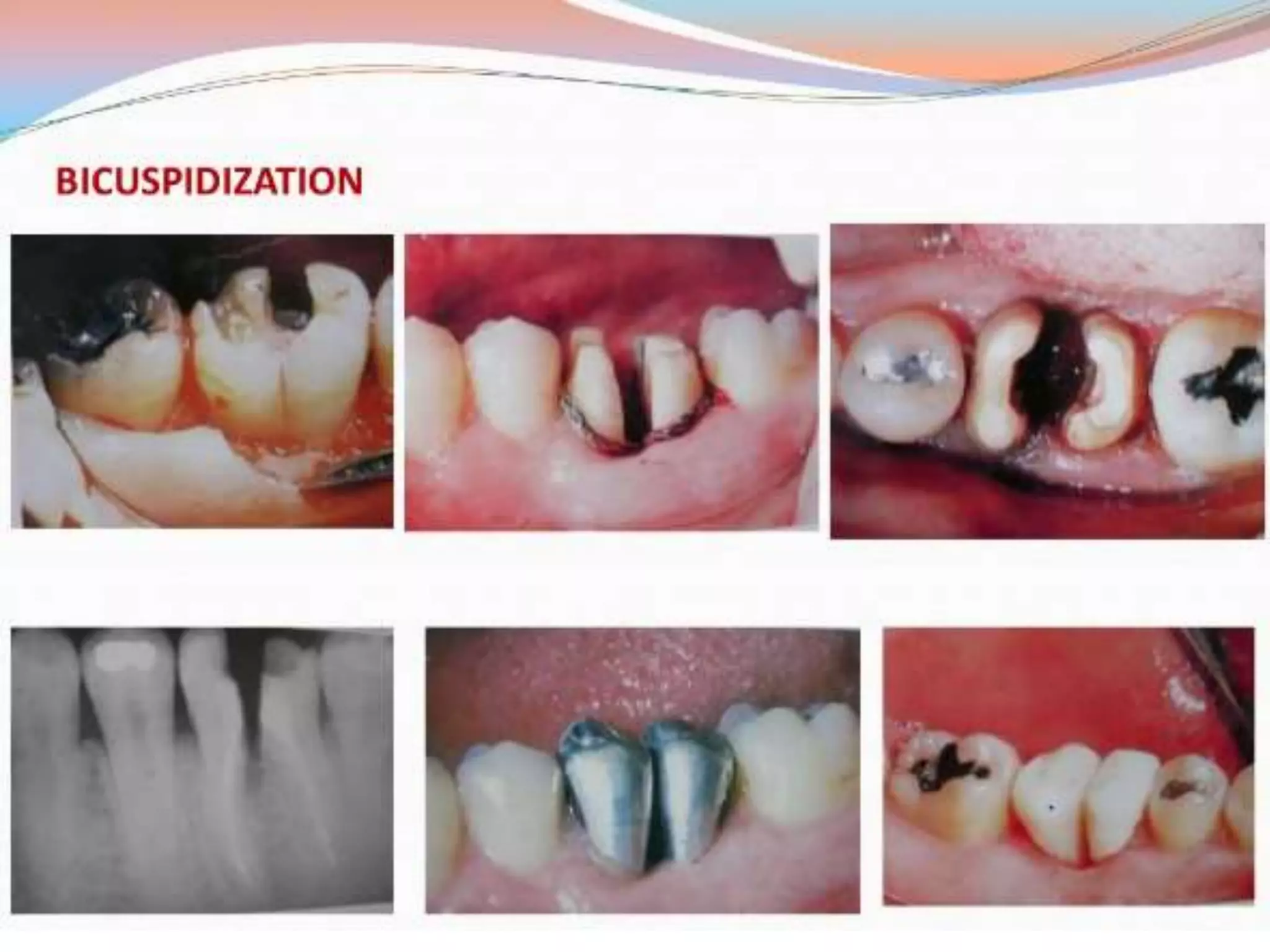 ENDODONTIC TREATMENT PROCEDURES.pptx