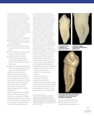 L’anatomia endodontica: possibilità diagnostiche e corretto approccio ...