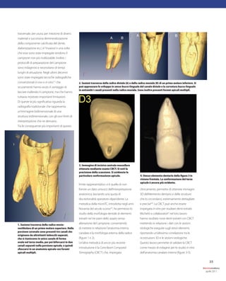 L’anatomia endodontica: possibilità diagnostiche e corretto approccio ...