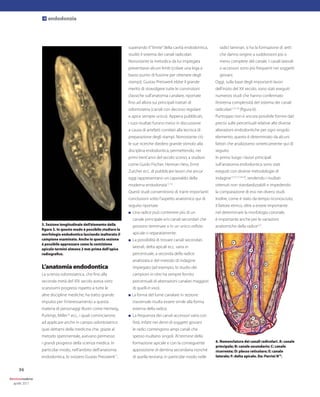 L’anatomia endodontica: possibilità diagnostiche e corretto approccio ...