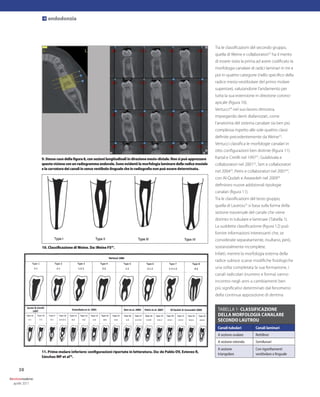 L’anatomia endodontica: possibilità diagnostiche e corretto approccio ...