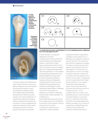 L’anatomia endodontica: possibilità diagnostiche e corretto approccio ...