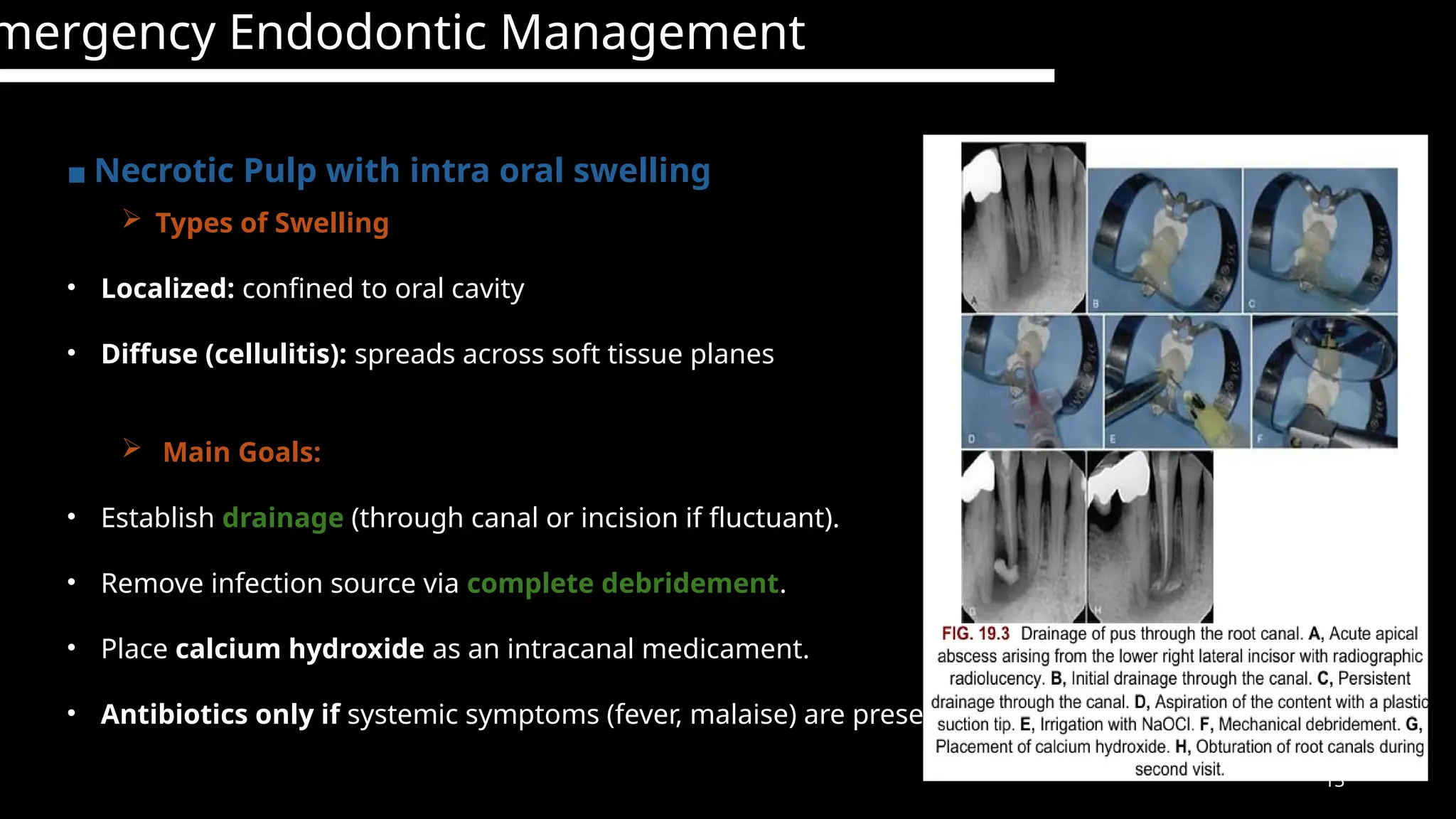 management of endodotics emergencies.pptx
