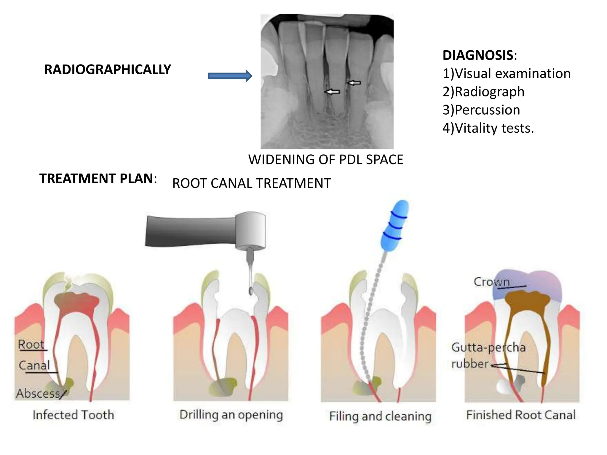 endo emergencies.pptx