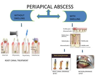 endo emergencies.pptx