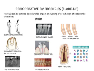 endo emergencies.pptx